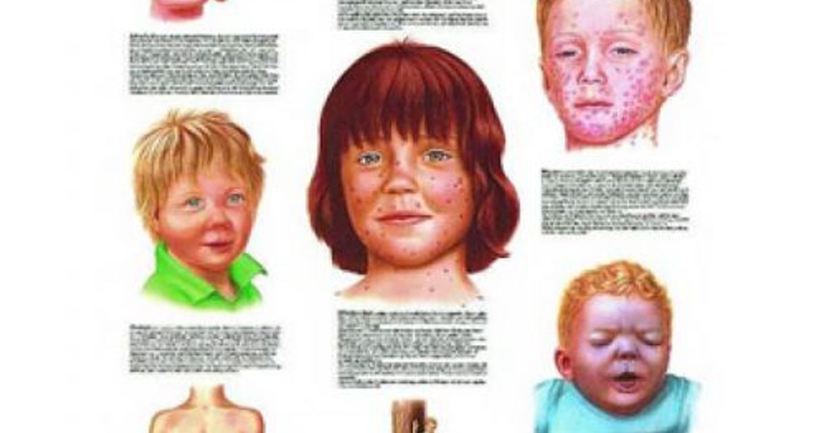 Poster Les Maladies Infantiles