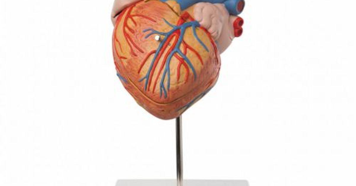 Human Heart Model with Bypass, 2 times Life-Size, 4 part - 3B Smart Anatomy
