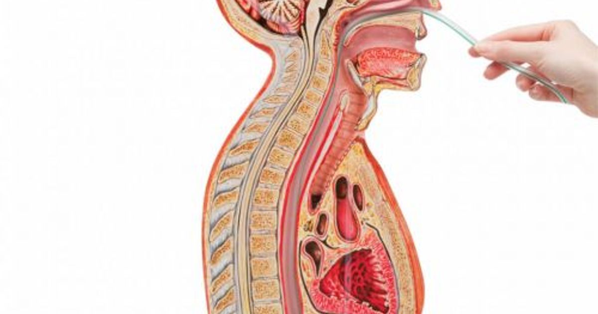 Modèle D'intubation Nasogastrique