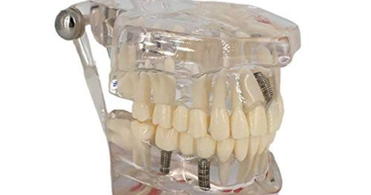 Complete Dental Lab Model