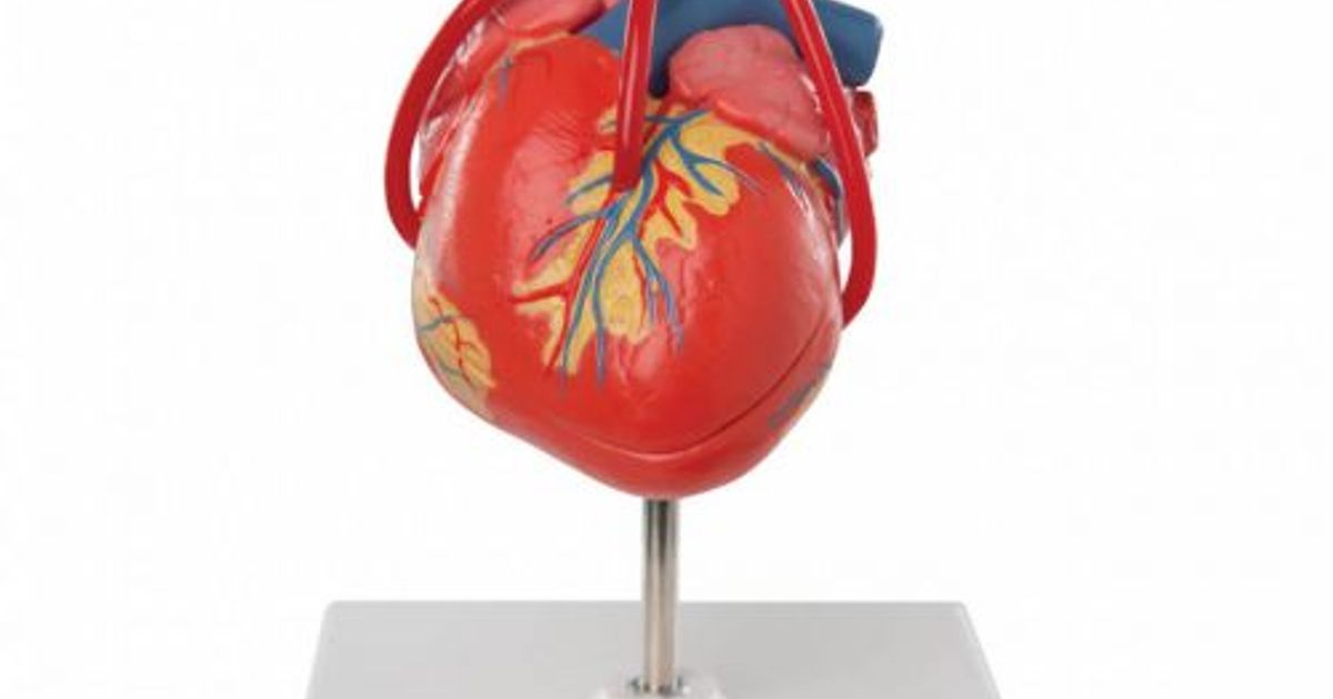 Classic Human Heart Model with Bypass, 2 part - 3B Smart Anatomy