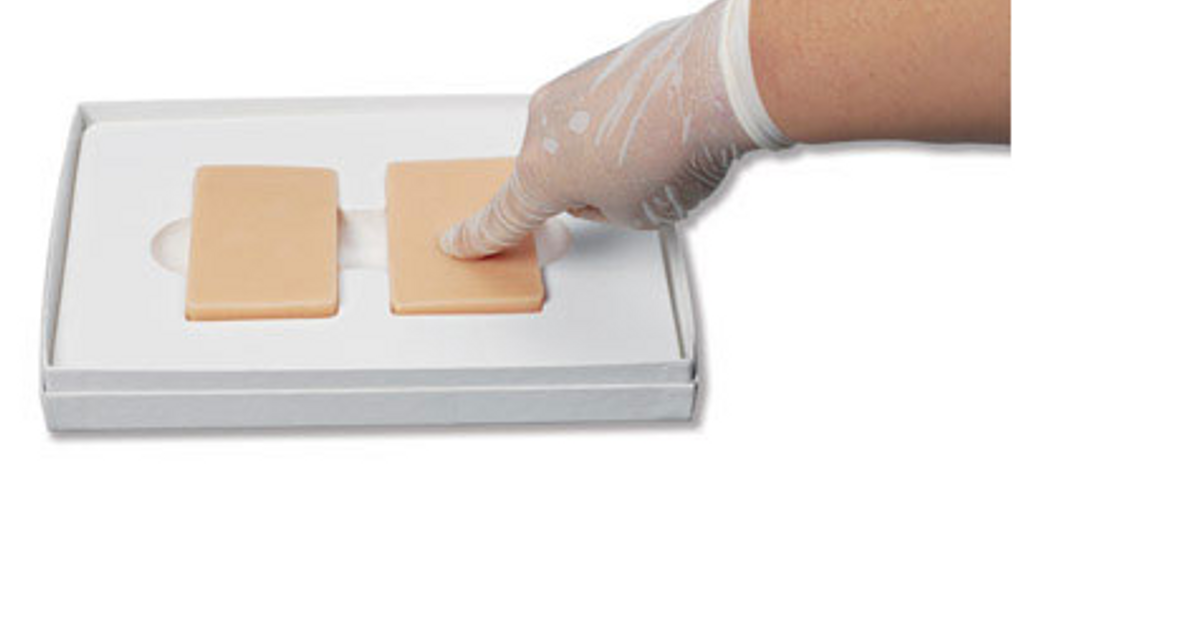 Non-Pitting Edema Trainer