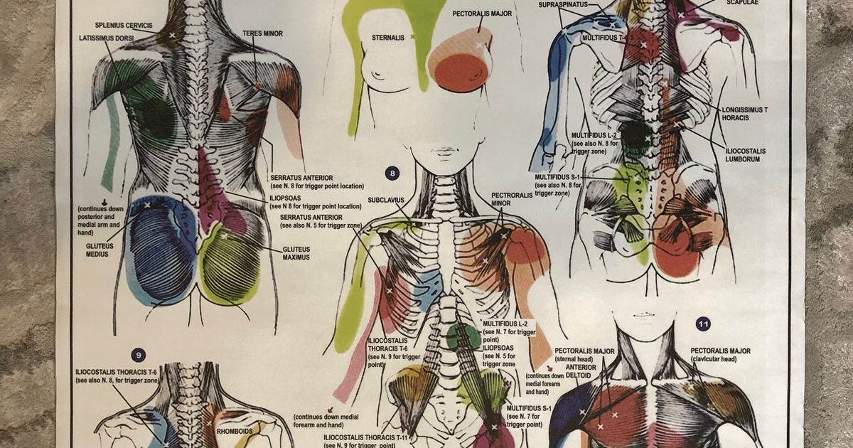 Trigger Points pull-down table