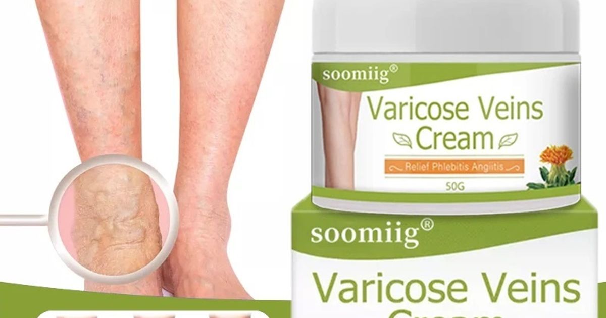 Varicose Vein Repair Cream - Fast-acting formula: absorbed quickly and ...